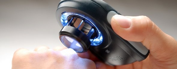 Dermatoscopia digital! Mapeamento de pintas na pele! O que é e quanto ...
