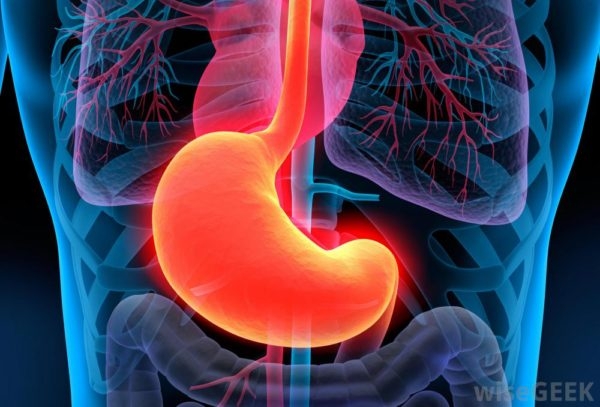 Gastrina elevada, quais as causas e sintomas? - Saúde Melhor