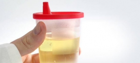 Acidose: o que é, sintomas e tratamento! - Saúde Melhor